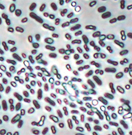 The Top Ten Microbes in Your Wine - Palate Press