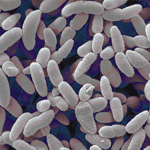 The Top Ten Microbes in Your Wine - Palate Press